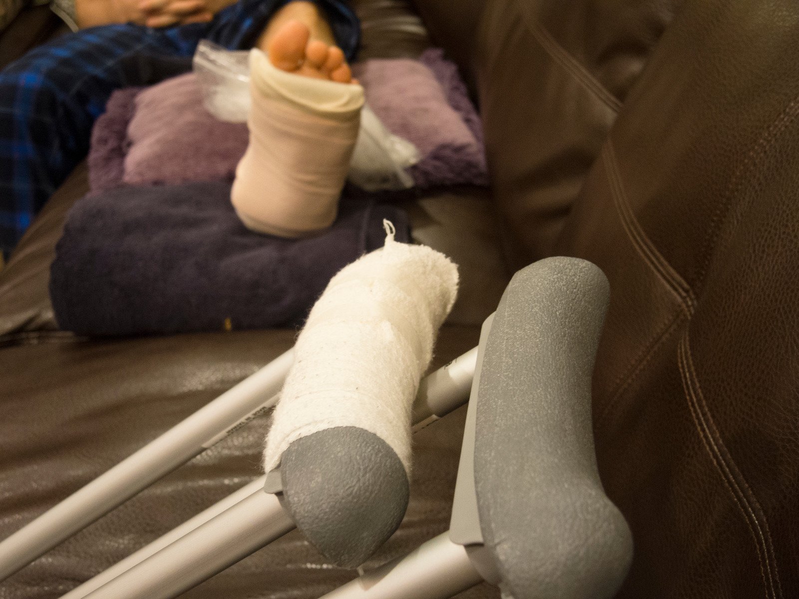 Stepping Toward Recovery: Your Guide to Foot Surgery Rehabilitation